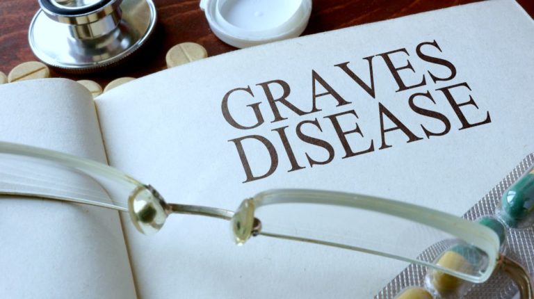 Graves’ Disease Symptoms, Causes, And Treatment - Liv Health Blog